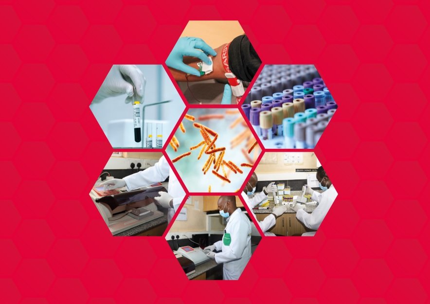 New manual on IGRA tests for TB infection launched | EATG