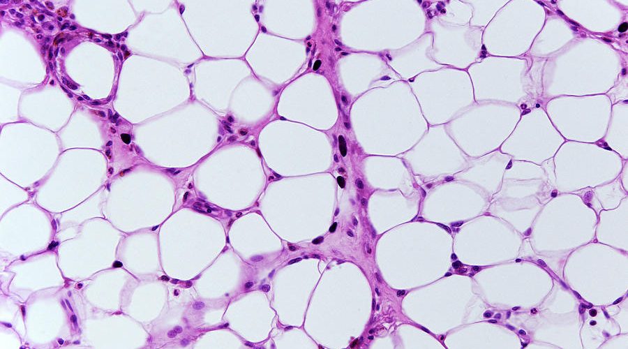 Immune system’s role in metabolic disease detailed in tissue atlas | EATG